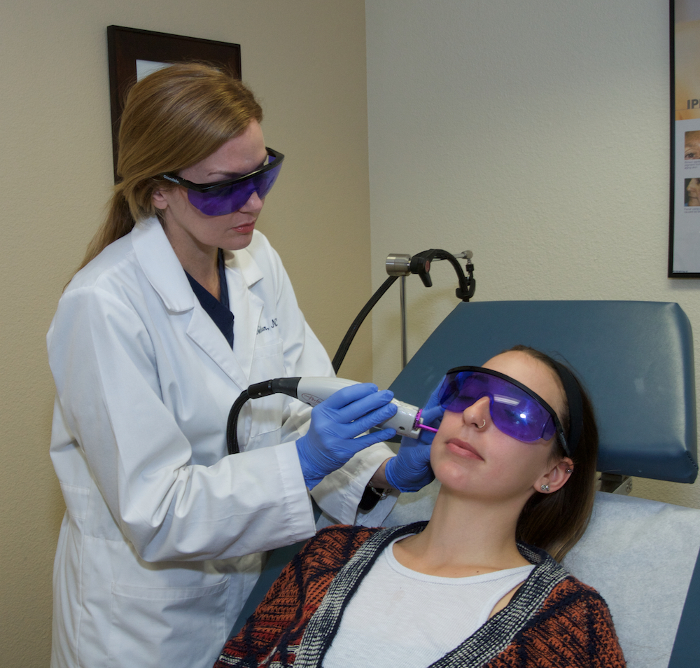 Laser Skin Resurfacing San Diego Del Mar CA