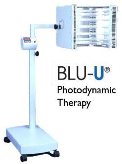 Photodynamic BLU-U Blue Light Acne Therapy San Diego Del Mar CA